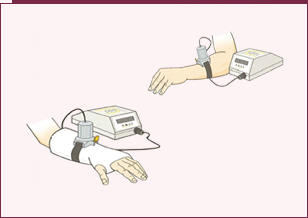 JB Implants Services verkoop van productmerken Igea BioPro Merete TRB ...
